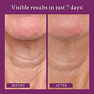 PRAI Neck Creme for Tightening & Firming Beauty | Neck Firming Cream That Boosts Elasticity | Cruelty & Paraben-Free Vegan Neck Tightening Cream | Neck and Chest Firming Cream With Hyaluronic Acid