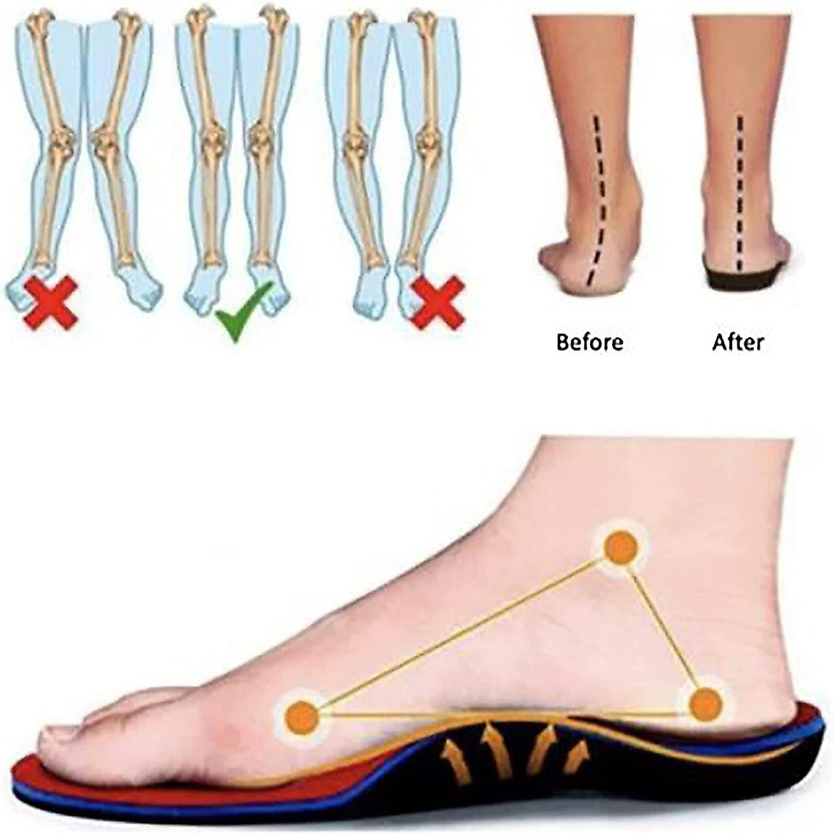 Women's Orthopedic Sneakers, Mesh Up Stretch Platform Sneakers, Comfortable Casual Fashion Sneaker Walking Shoes. (Brown,5.5)