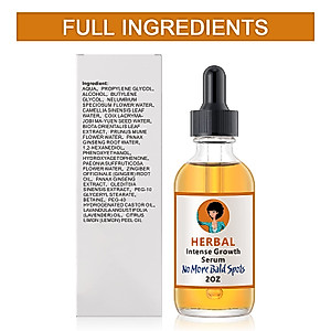 Ginger Hair Growth Serum - Treats Thinning, Hair Loss, Dry & Itchy Scalp, Dandruff - Hair Regrowth Treatment for Men and Women - 2OZ