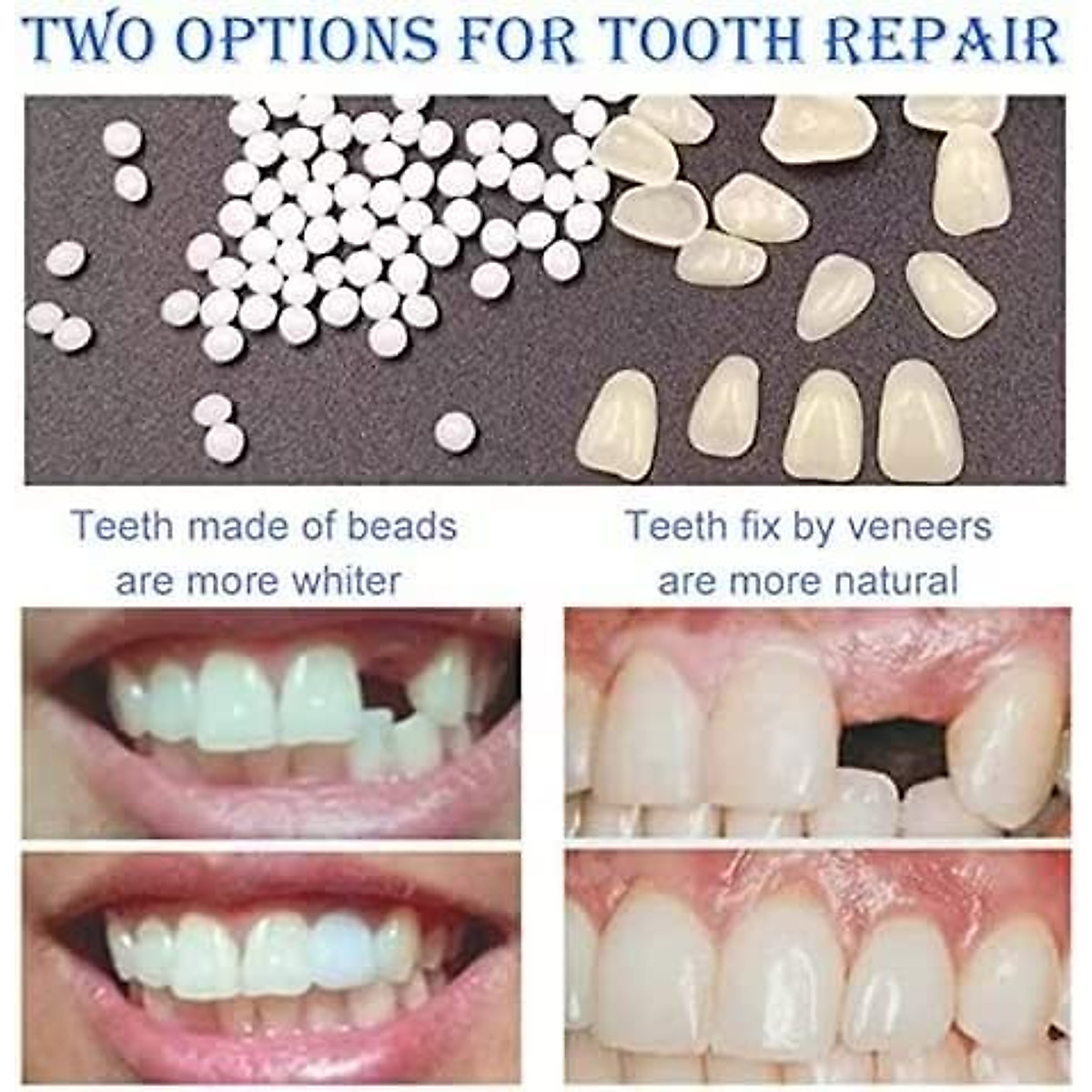 Tempoary Tooth Repair Kits DIY Dental Care Kit Glue for Filling Missing Broken Teeth Crowns and Bridges Moldable Fake Teeth to Regain Your Beautiful Smile in Minutes-White Color