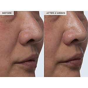 Glow Recipe PHA + BHA Face Toner - Skin Care Toner, Pore Minimizer & Gentle Face Exfoliant - Exfoliating, Soothing, Tightening & Hydrating Toner with Hyaluronic Acid & Watermelon (150ml)