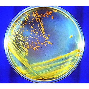 Tryptone (Pancreatic Digest of Casein) - 10 Grams