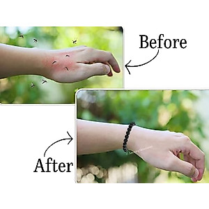 Mosquito Repellent Bracelets and Anklet Repeller with Essential Oil Refill Container - Lava Stone Camping Essentials Mosquito Bracelets for Adults Bug Repellent Bracelets - Pack of 2 Bug Bands