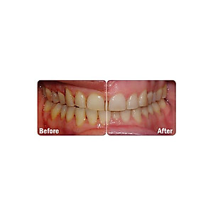 ProBiora Oral-Care Chewable Probiotic Tablets | Probiotic Supplement for Women & Men | Healthier Teeth & Gums | Fresher Breath | Whiter Teeth | Better Overall Health (30 Count, Extra Minty)