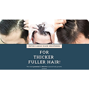 Peter Lamas Biotin Shampoo for Men & Women, DHT Blocker Shampoo, Promotes Hair Growth for Thicker and Fuller Hair, Complete Dry Scalp Treatment with Peppermint Oil for Daily Hair Care