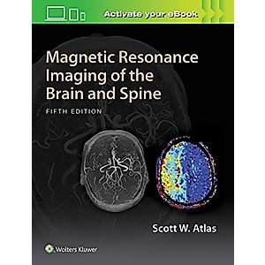 Magnetic Resonance Imaging of the Brain and Spine