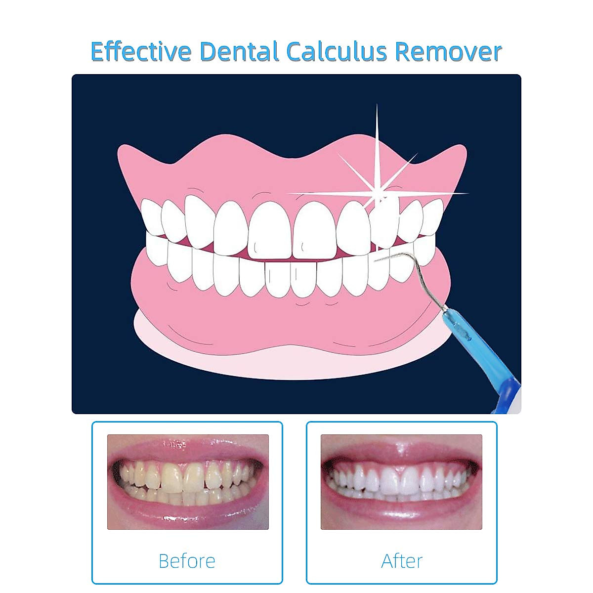 Tooth Stain Remover Tool Oral Care Cleaning Kit with LED Light for Dentist, Family Oral Cleaning, Dental Scraper Tooth Pick Hygiene Set with Mouth Mirror - Easy to Carry and Use