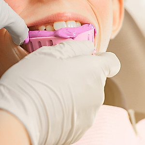 JMU Full Arch Bite Registration Trays 30 Pcs, Disposable Dental Impression Trays for Teeth Modes Pink