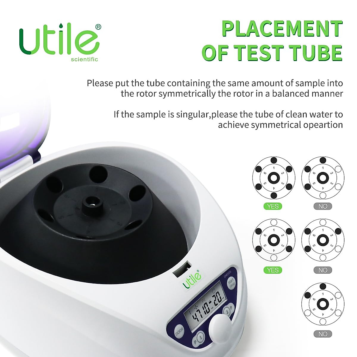 Utile Lab PRP Benchtop Centrifuge Machine with LCD Display, 6x15mL/10mL/7mL/1.5-5ml Lab Centrifuges 300-5000RPM Max. 2600xg RCF for Laboratory School, 4620.3004.1