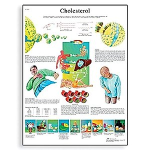 3B Scientific VR1452L Glossy Laminated Paper Cholesterol Anatomical Chart, Poster Size 20" Width x 26" Height