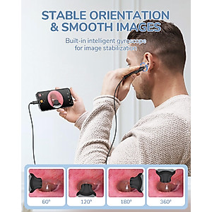 ScopeAround Otoscope Ear Camera, Ear Wax Removal Tool 1080p FHD Video Otoscope, 3.9mm Ear Wax Removal Camera with 6 LED Lights Visual Ear Scope, Compatible with iPhone15 & Android