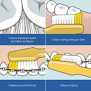 TEPE Nova Medium Firm Toothbrush for Adults with Tapered Head, Angled Neck, and Thumb Grip, Pack of 1