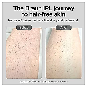 Braun IPL Long-lasting Hair Removal System for Women and Men, NEW Silk Expert Pro 3 PL3221, Head-to-toe Usage, for Body & Face, Alternative to Salon Laser Hair Removal, With 3 Extra Caps