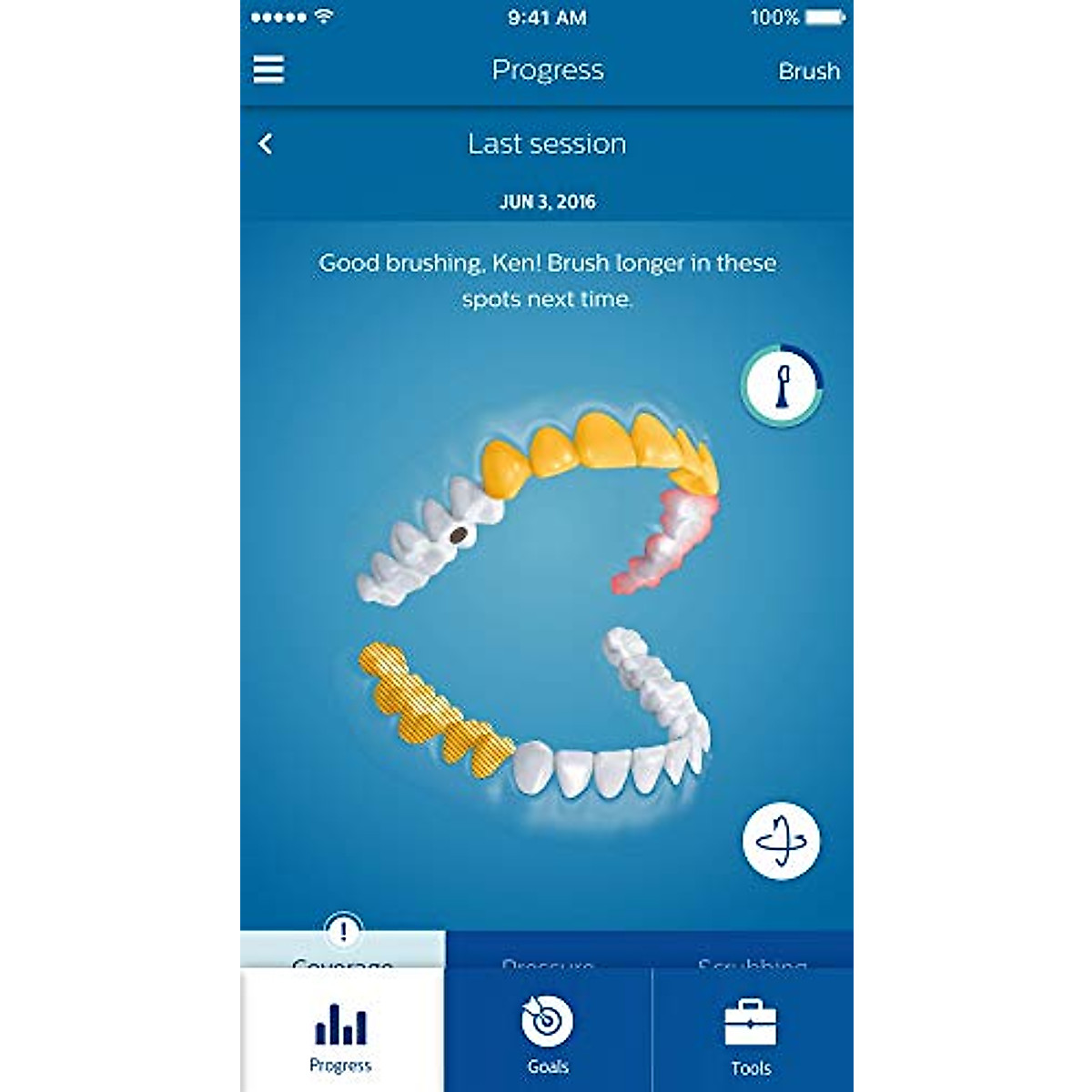 Philips Sonicare DiamondClean Smart 9700 Rechargeable Electric Power Toothbrush, Lunar Blue, HX9957/51