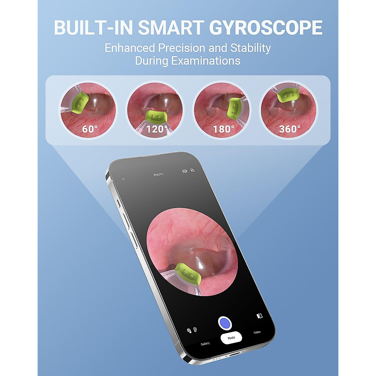 ScopeAround Wireless Otoscope with Light Ear Camera, 3.9mm Ear Wax Removal Tool Camera, 720P HD with 6 LED Lights, WiFi Wireless Otoscope Camera, Ear Scope Compatible with Android and iPhone