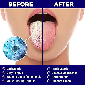 Tongue Scraper Stainless Steel | Two-Pack | Tongue Cleaner | for a Fresh Breath and Better Oral Health | Stainless Steel Tongue Scrapers | Tongue Cleaner for Kids and Adults | ORAVIX