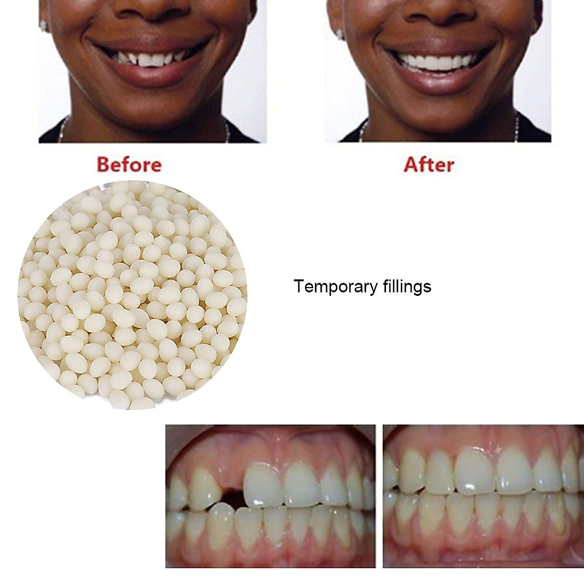 Temporary Tooth Repair Gaps, 30g False Teeth Solid Glue, Filling Denture Adhesive, Teeth Care Tool, Dental Gaps Filling for Temporary Cover, for The Missing Broken and Deformity Teeth Improve Smile (