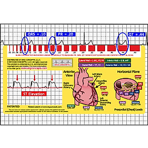 R-CAT EKG Window 2nd Edition