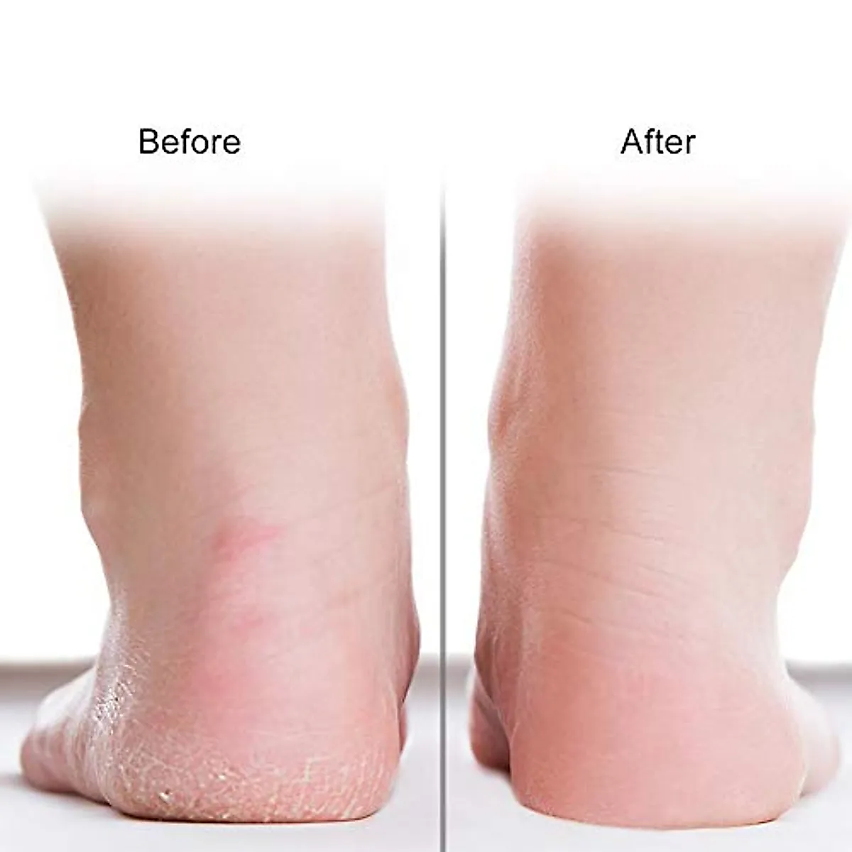 Silicone Sock, 1pair Crack-Proof Moisturizing Socks Protector Foot Care Tool Prevention Socks for Women with Breathable Hole for Dry Cracked Heel(L-02#)