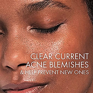 Vichy Normaderm Daily Acne Face Wash, Salicylic Acid Face Cleanser for Oily & Acne Prone Skin, Acne Cleanser that Clears Clogged Pores and Blackheads, Cleansing Gel for Clear Skin