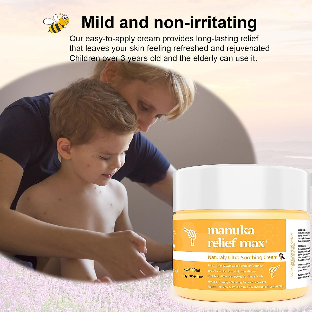 UEUEKOKO Eczema Psoriasis Manuka Relief Honey Cream, Hand Foot, Tinea Versicolor, Itchy Feet, Butt, Anal Itch, Scalp Dandruff, Bee Sting, Bites, Boil Cyst, Armpit, Adults Kids, Hidradenitis Treat