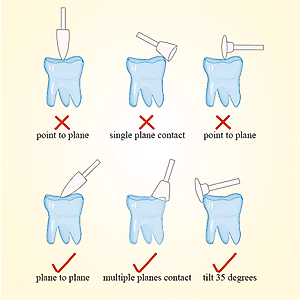 Supershu Polishing Kit For Composite