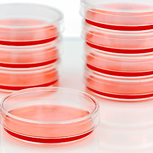 40Pack Plastic Petri Dishes Set, 4 Inch Culture Dish Plates with Lids, Clear Culture Plates with 100Pcs 3ml Transfer Pipe for School Studies, Science Projects, Art Projects