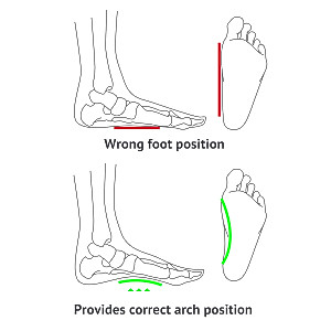 BRISON Plantar Fasciitis Relief - Arch Support Orthotics Inserts Brace - Adjustable Compression Helps with Planters Facetious Flat Foot Pain Foot Care Black