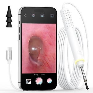 Ear Specula Set for ScopeAround Digital Otoscope, Set of 50 Pieces, Replacement Otoscope Tips, Ear Speculum, Compatible with ScopeAround SA39W/SA39i/M28/MS450 Otoscope