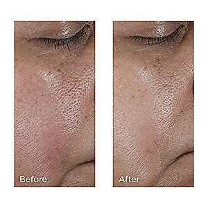 Perricone MD No: Rinse Intensive Pore Minimizing Toner 4 Ounce