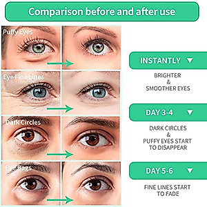 BREYLEE Aloe Vera Eye Mask– 60 Pcs - Puffy Eyes and Dark Circles Treatments – Look Younger and Reduce Wrinkles and Fine Lines Undereye, Improve and Firm eye Skin - Pure Natural Material Extraction