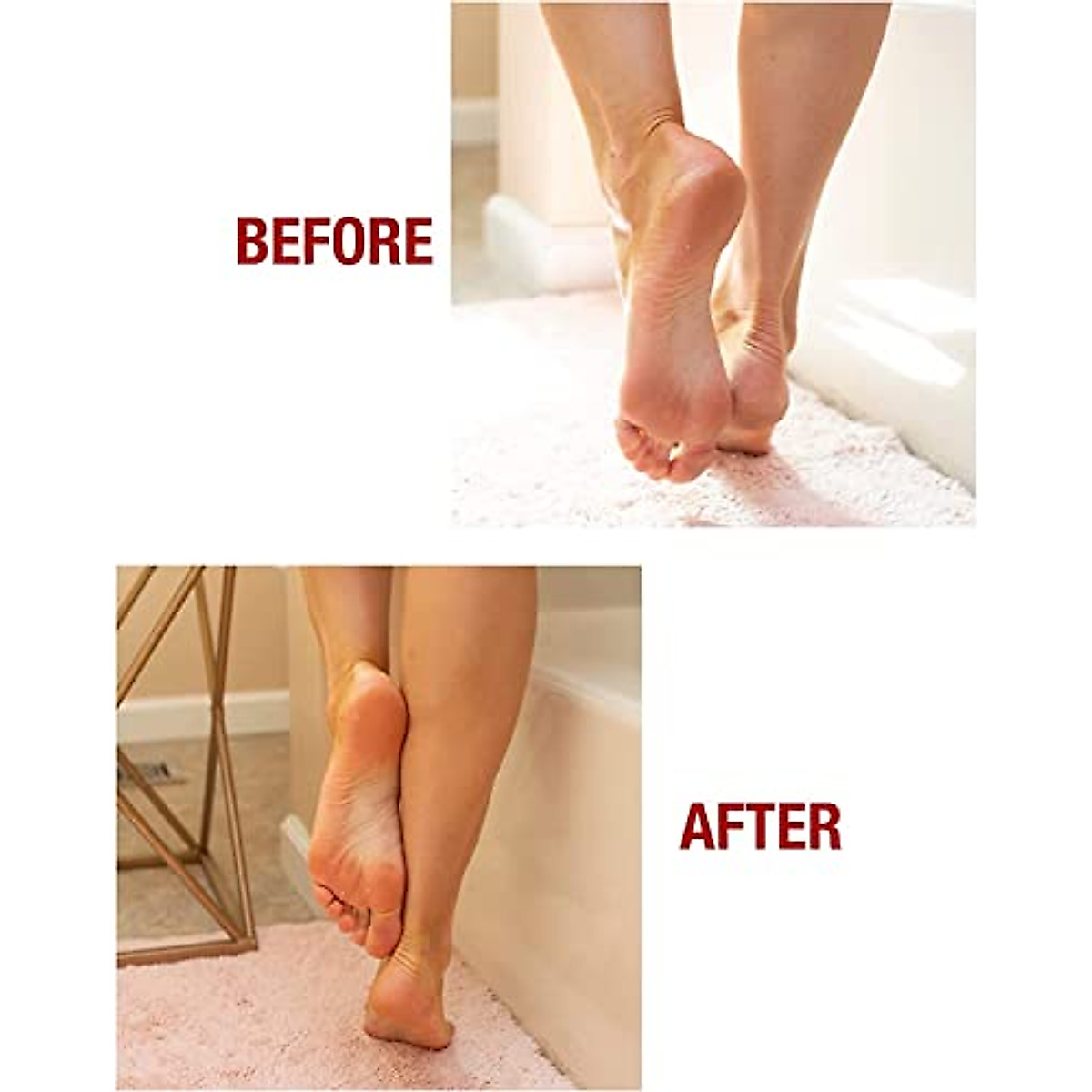 Kerasal Intensive Foot Repair Skin Healing Ointment, 1 Oz and Moisturizing Gel Socks, One Pair (Packaging May Vary)