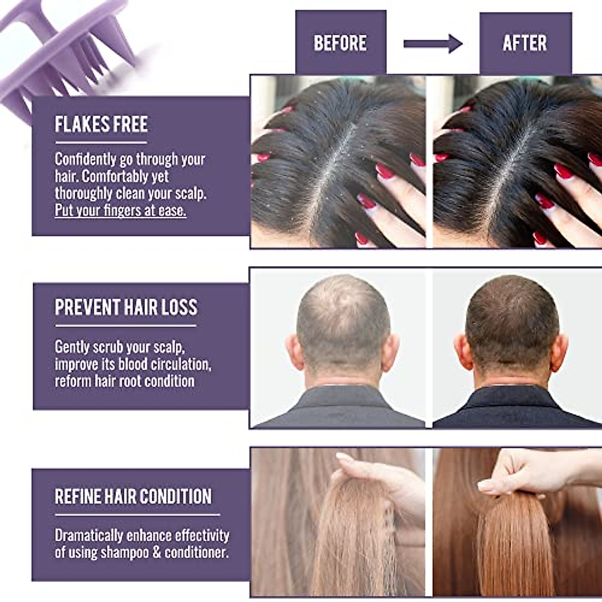 WAKISAKI (2-Pack) Hair Scalp Massager for Hair Growth, Mold-Free Silicone Scalp Massager Shampoo Brush, Scalp Scrubber Exfoliator for Dandruff Itchy Flaky Scalp, Works for Wet and Dry Hair, (Purple)