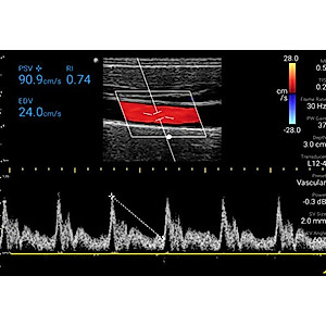 Philips FUS6882 Lumify L12-4 Linear Array Transducer, Portable Ultrasound Solution