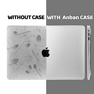 Anban Compatible with MacBook Pro 13 inch Case M2 2022, 2021 2020 2019 2018 2017 M1 A2338 A2251 A2289 A2159 A1989 A1708 A1706 Touch Bar, Clear Plastic Hard Shell Case +Keyboard Cover +Screen Protector