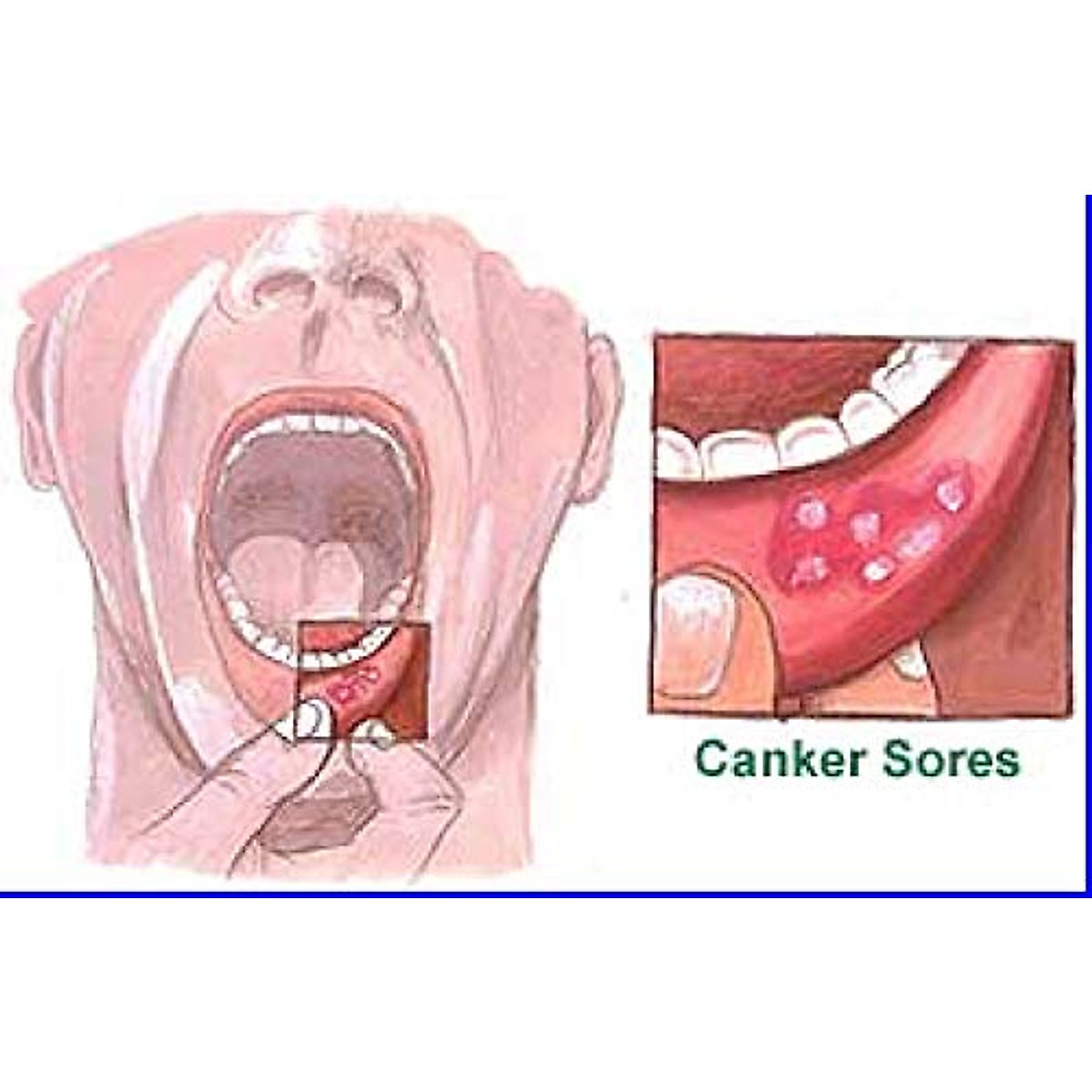 Miracle Write Smile - Essential Oxygen Rinse Mouthwash for Whiter Teeth, Fresher Breath, and Healthier Gums, Peppermint 12 fl. oz