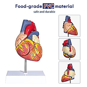 LVCHEN 2X Enlarged Anatomical Heart Model - Human Heart Model with Rigth/Left Atrial Appendage Anatomical Model for Science Classroom and Cardiology Study