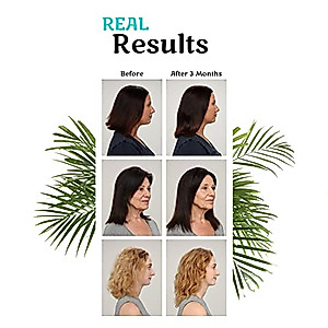 Hair La Vie Clinical Formula Hair Growth Vitamins for Women and Men with Biotin 5000mcg, Collagen, and Saw Palmetto - Healthy Hair Growth Supplement Within Normal ranges 90 Count (Pack of 1)