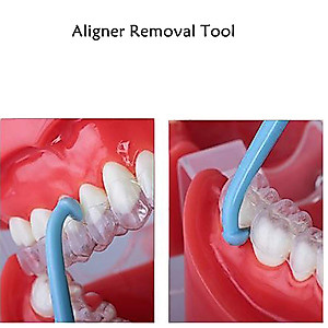 4 Pcs Remover Tool Clear Aligner Removal Tool for Invisible Removable Braces (Clear)