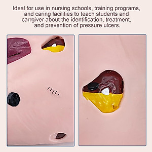 Human Wound Care Model Bedsore Nursing Human Model Pressure Ulcers Manikin Teaching Human Simulator for Nursing Teaching
