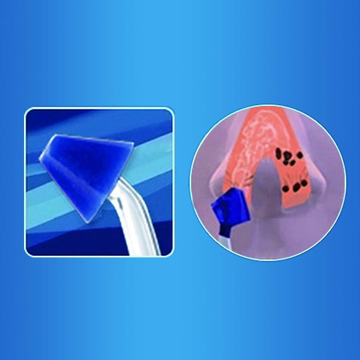 WyFun Nose Washing Replacement Tips for Waterpik Oral Irrigator Wp-100 Wp-450 Wp-250 Wp-300 Wp-660 Wp-900 by WyFun