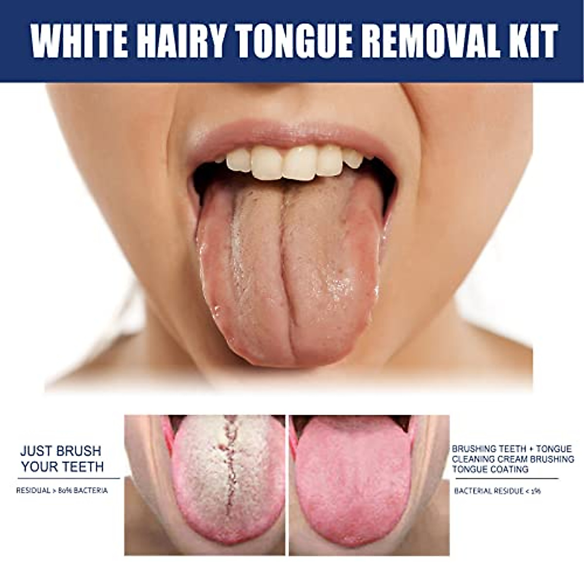 Tongue Cleansing Gel, 50g Ergo Handle 2 Pcs Oral Refreshing Tongue Scrubber Brush Adult Plaque Removal Kit for Bad Breath