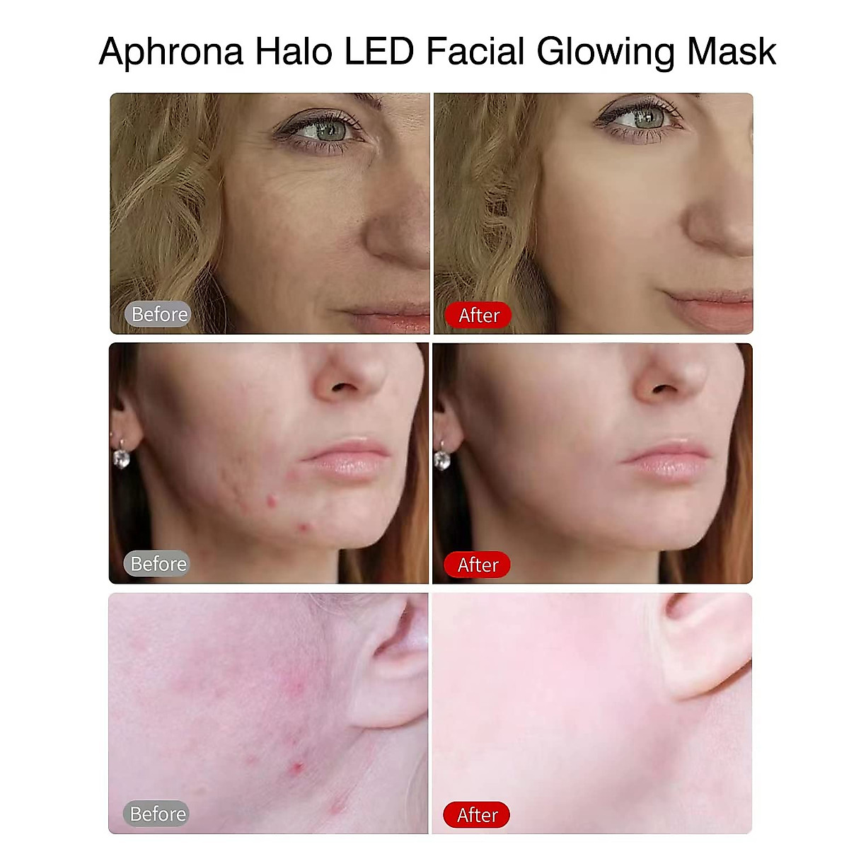 Aphrona® Halo Led Light Therapy Face LED Light Therapy skin care Photon Mask, Blue Light Red Light for Acne Treatment Fine Line Wrinkle Removal (White)