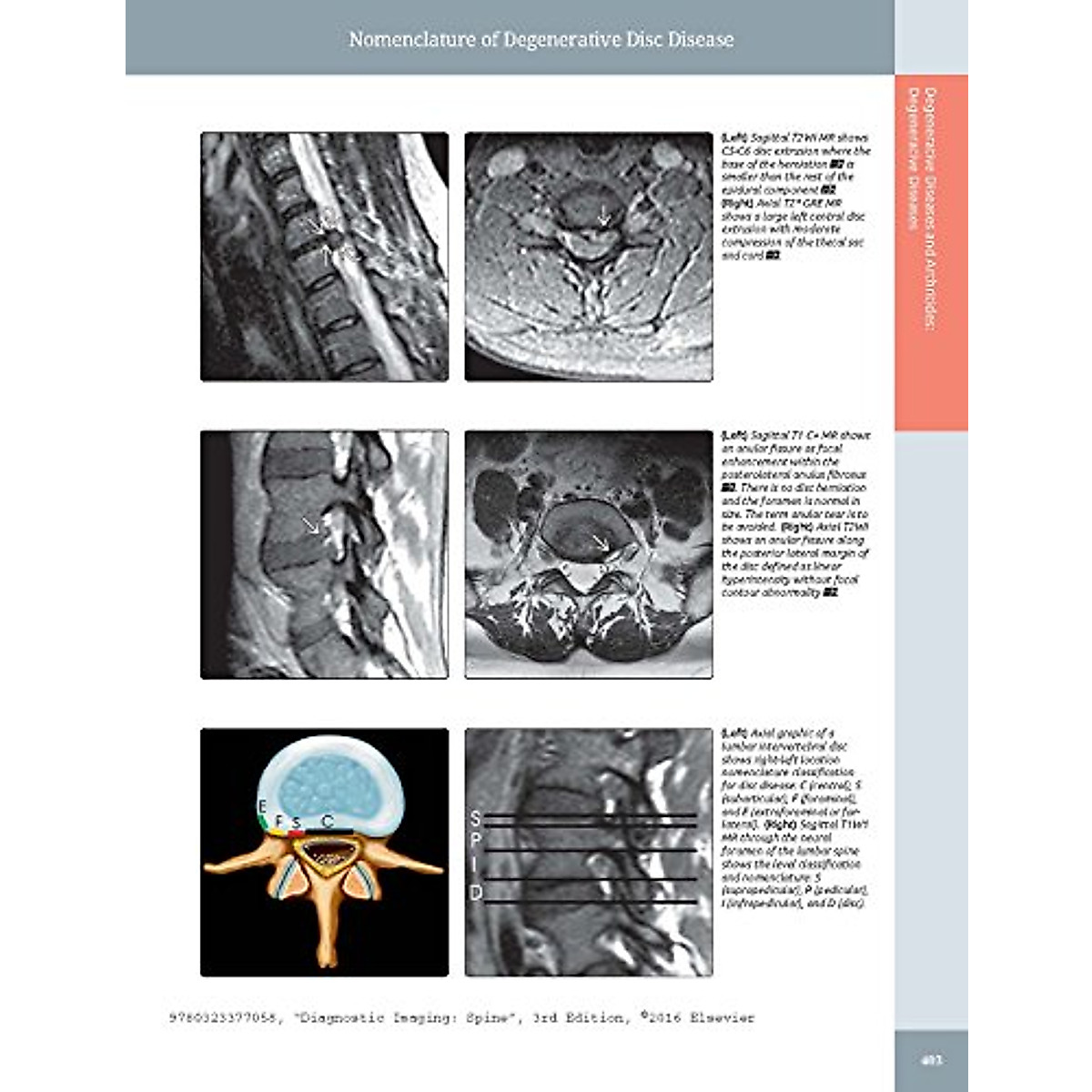 Diagnostic Imaging: Spine