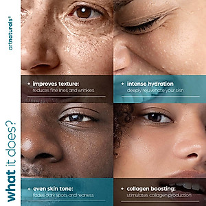 ArtNaturals Hyaluronic Acid Serum (4 Fl Oz / 118ml) - Anti- Aging Facial Serum, Natural Moisturizer w/Vitamin C Serum & Vitamin E - for Skin Care - Reduce Wrinkles & Dark Spots for Brightening Face