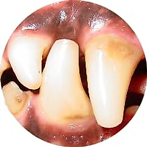 Plaque Attack Gel with Wild Salmon Oil. As Seen On TV Pet Dental, Don't Mess with Harsh Chemicals in Your pet's Food or Water, Simply Swipe on Teeth and Your pet's Teeth and Gums Will Improve.