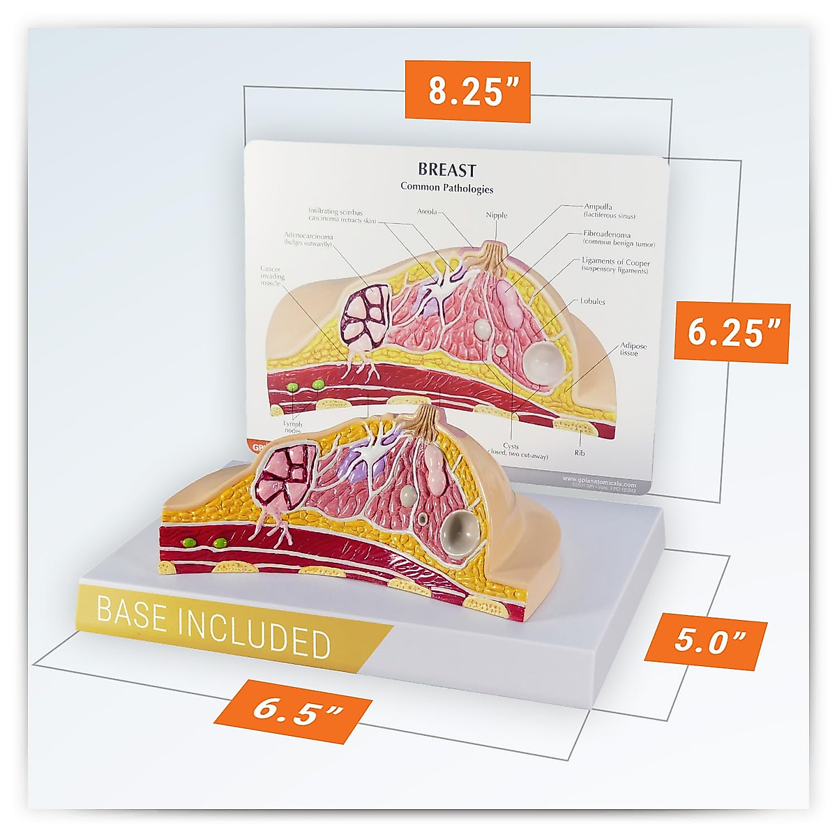 Breast Cross-Section Model | Human Body Anatomy Replica of Breast w/Common Pathologies for Doctors Office Educational Tool | GPI Anatomicals