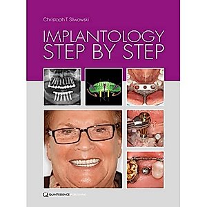 Implantology Step by Step