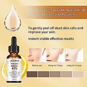 Facial Peeling Serum with 45% Citric Acid Facial Deep Exfoliating Face Chemical Peel for Acne Dark Spots Wrinkles and Fine Lines-Skin Brightening Tightening Moisturizing Serum 30 ml/1 Fl oz