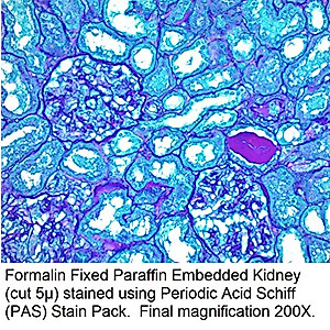 Periodic Acid Schiff (PAS) Stain Pack, 500ml